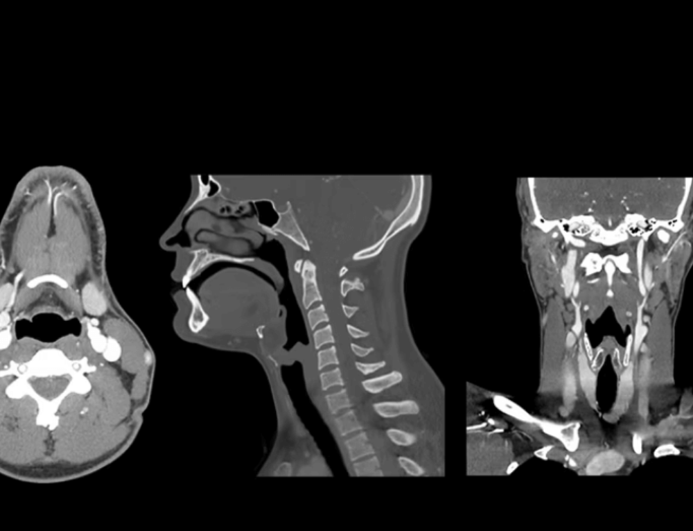 Tomografía con contraste oral y endovenoso | Diaude